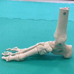 Lupavý (skákavý) palec a prsty ruky (digitus saltans) - Fyzionozka ...