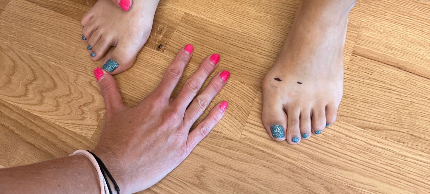 Lupavý (skákavý) palec a prsty ruky (digitus saltans) | Fyzionožka